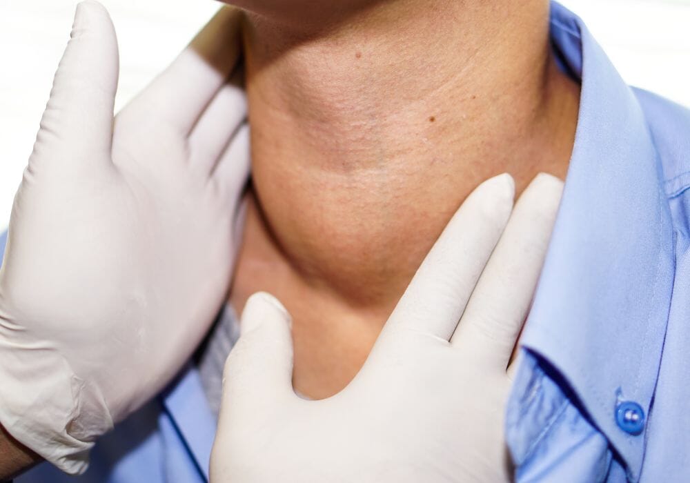 Tiroidectomia totale o parziale asportazione della tiroide Angelo Camaioni